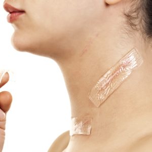 Littekenbehandeling – Plastische Heelkunde